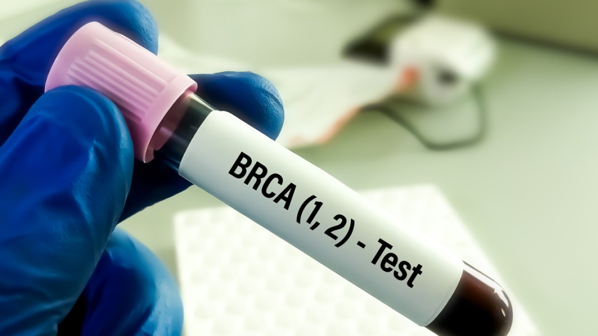 What to Expect When You’re Expecting a BRCA Test | Autostraddle